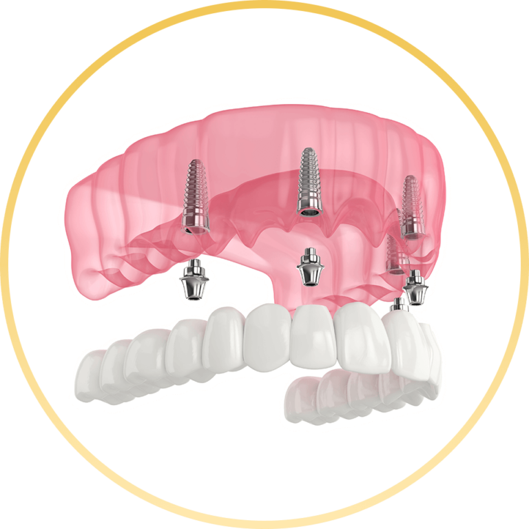 Home | Apex Oral Surgery and Implant Center