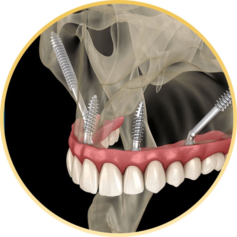 Home | Apex Oral Surgery and Implant Center